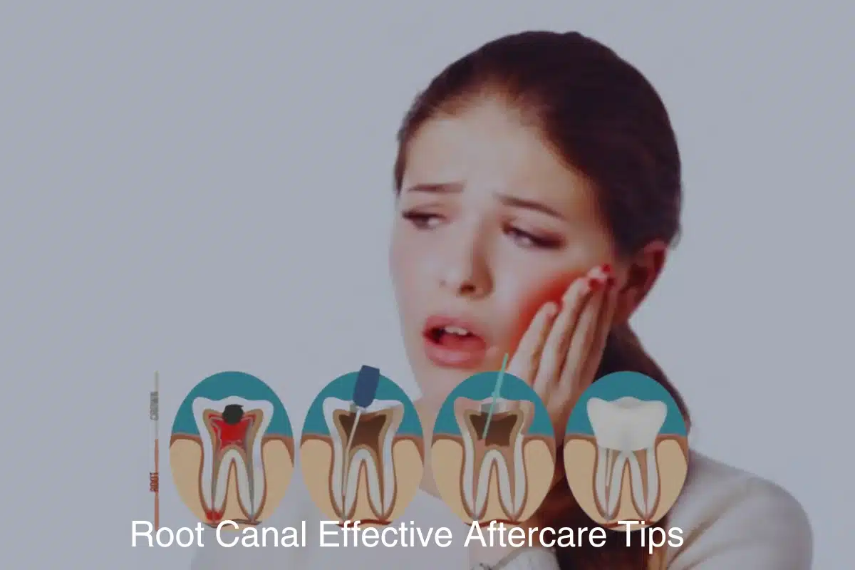 Why Dentists Recommend Essix Retainers as a Temporary Solution After ...